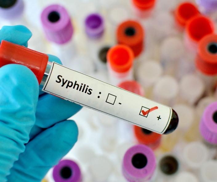 What is Syphilis? - Public health problems